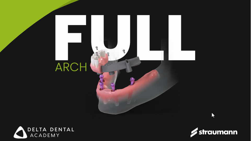 Delta Dental Academy: Straumann® Full Arch - Immediate Placement and ...