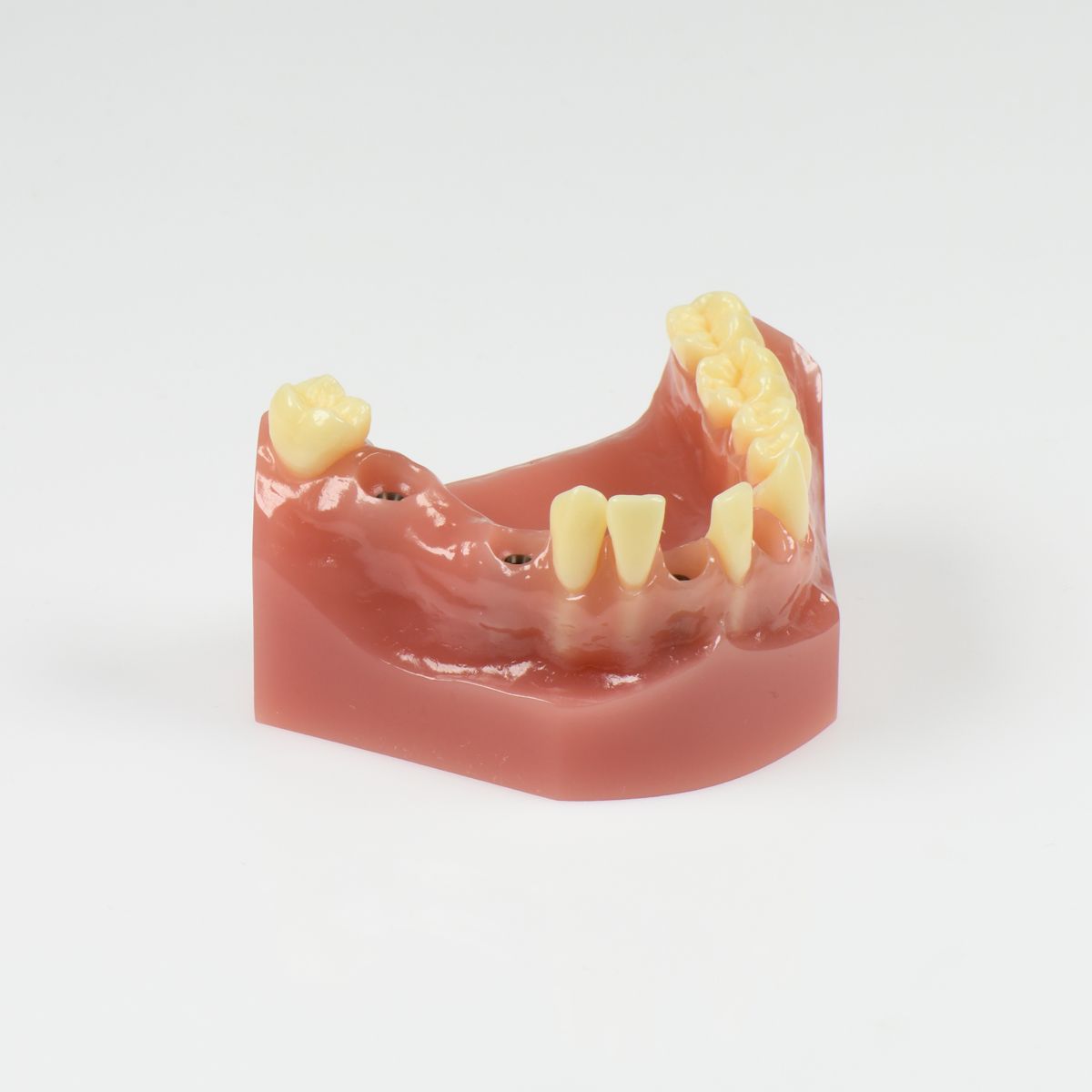 Patient model lower jaw, partially dentate, incl. NNC, NC,& RC, pink ...