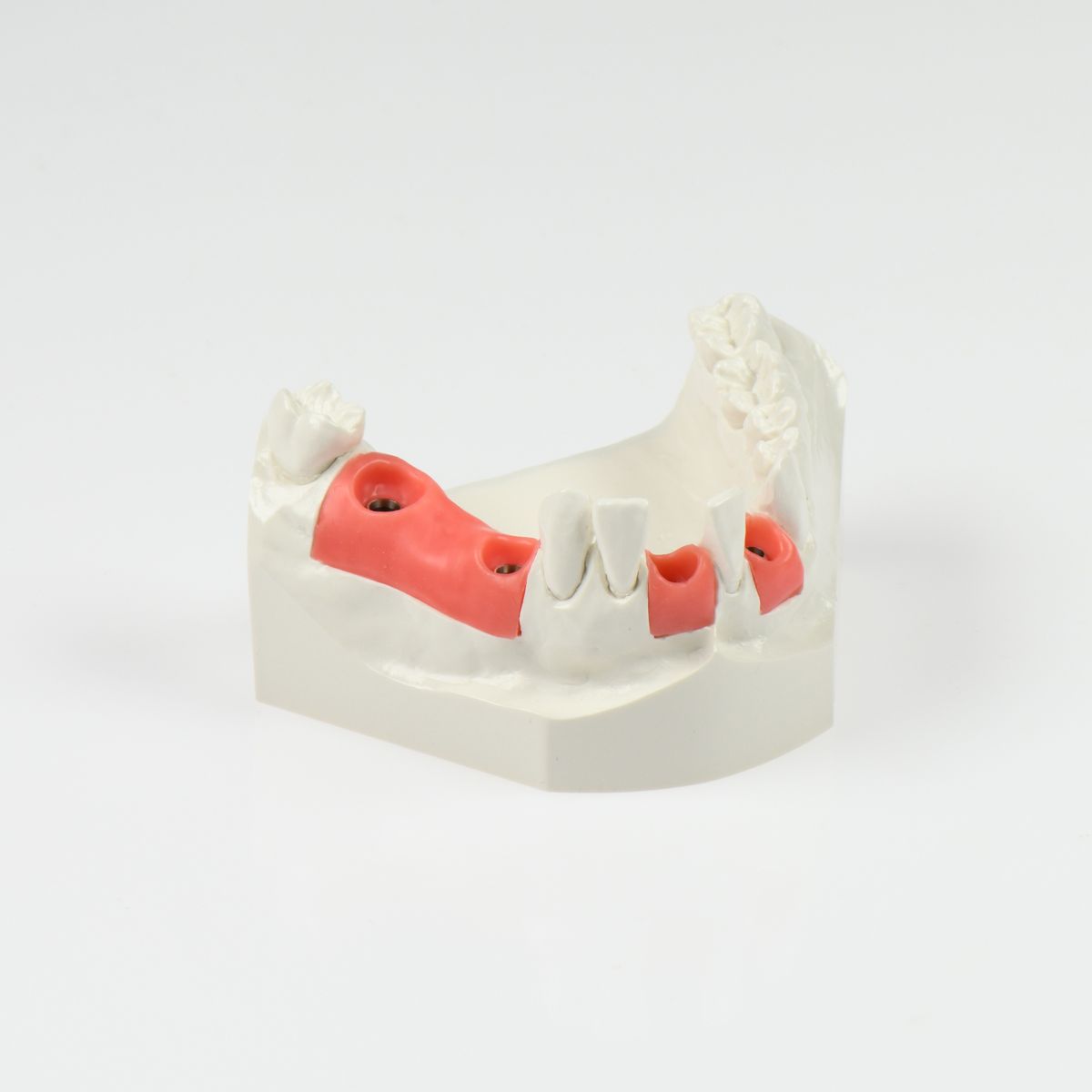 Lab model S/A mandible, incl. NNC, NC & RC | Straumann Group ...