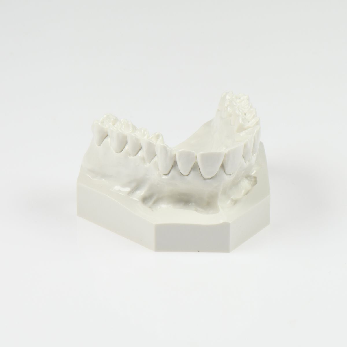 Lab model opposing maxilla | Straumann Group - Straumann 대한민국