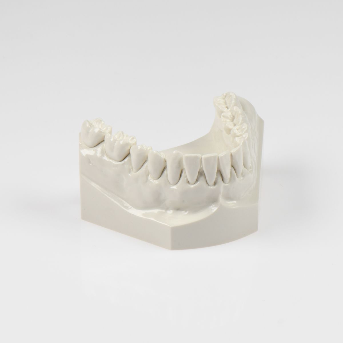 Lab model opposing mandible, for Lab model "S/A" maxilla | Straumann ...