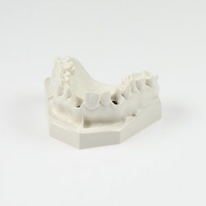 Prosthetic model upper jaw, for temporary restoration | Straumann Group ...