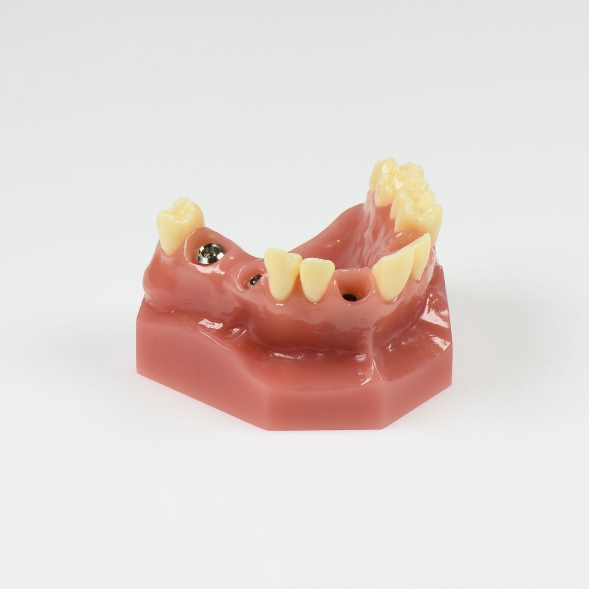 Patient model upper jaw, partially dentate, pink | Straumann Group ...