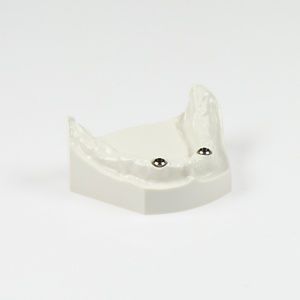 Lab model lower jaw, edentulous, white | Straumann Group - Straumann 대한민국