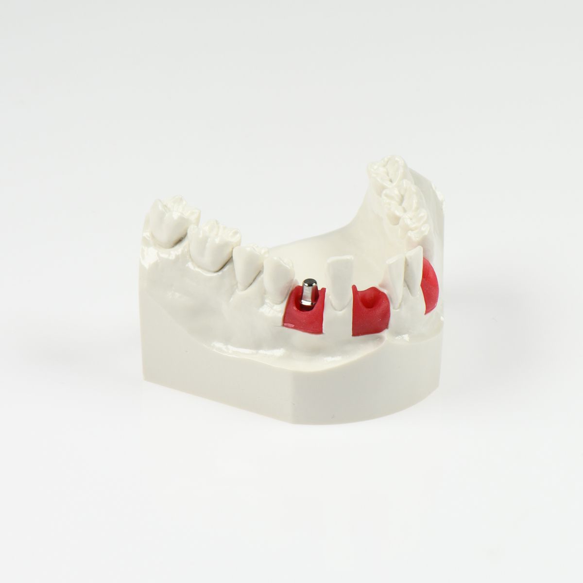 Lab Model S/A Mandible, incl. Ø 2.9mm BLT & PURE | Straumann Group ...