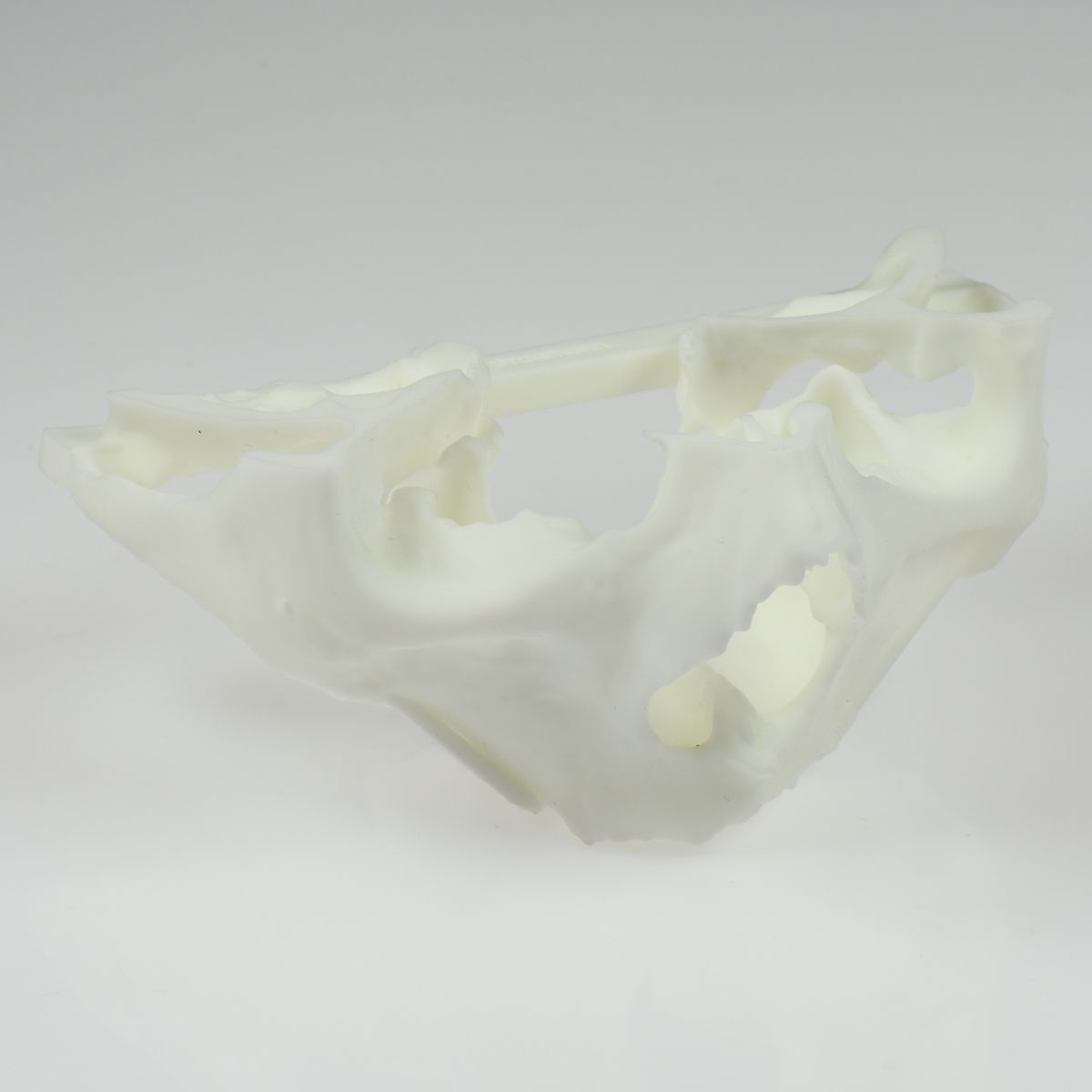 Zygomatic Surgical Model | Straumann Group - Straumann 대한민국