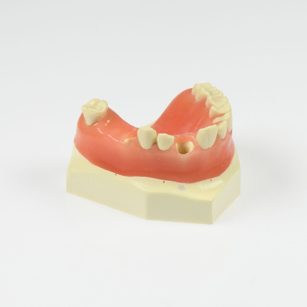 Maxilla Course Model, Guided Surgery | Straumann Group - Straumann 대한민국