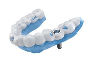 MLF EASY Chairside (12 mo., 5 Guide Fees) | Straumann Group - Straumann USA