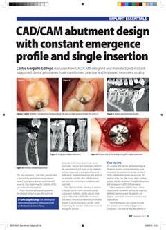 Axiom® Bone Level REG/PX - Dental Implants | Anthogyr