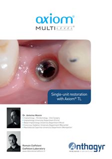 Axiom® Tissue Level - Dental Implants | Anthogyr