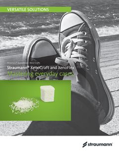 Straumann® Products and Solutions - More Than The Latest Technology