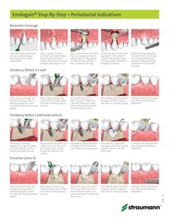 Straumann Emdogain - for better tooth prognosis and esthetic results