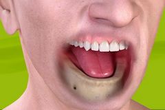 Straumann®️ ProArch - Immediate Fixed Full Arch Solutions