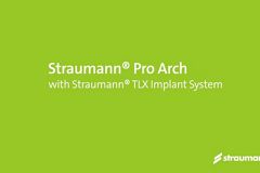 Straumann® TLX Implant System