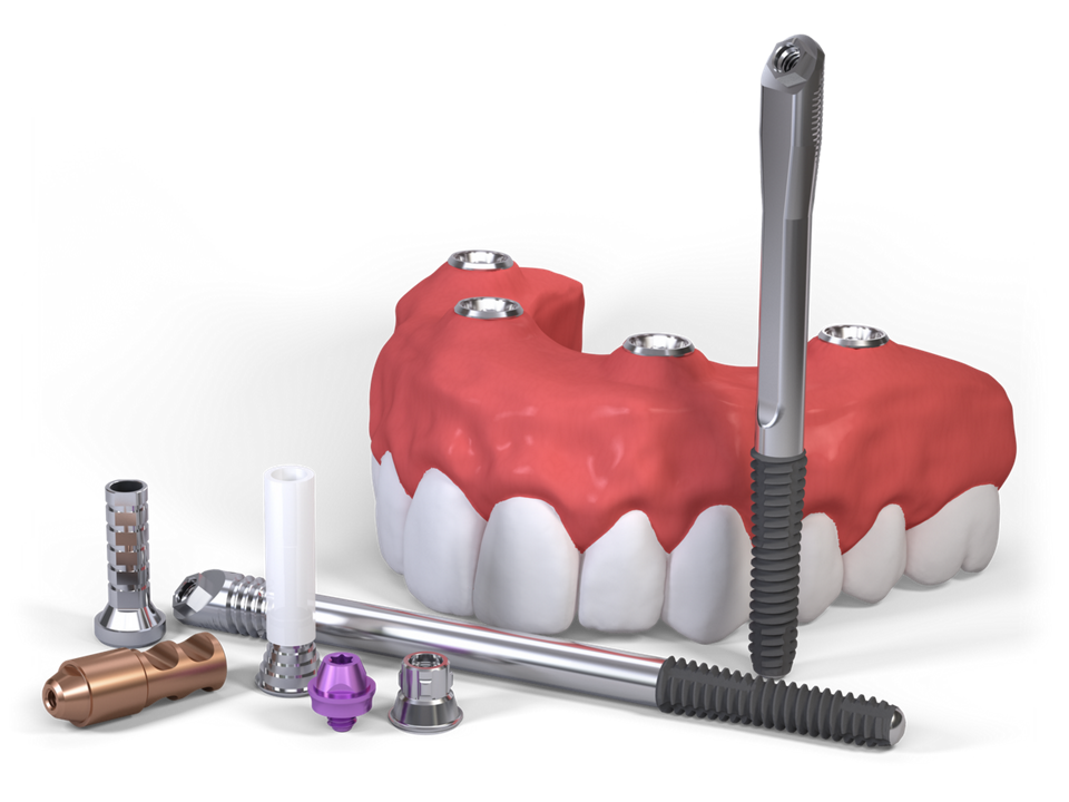 The ZAGA Concept for a minimally invasive “Canal Osteotomy” combined ...