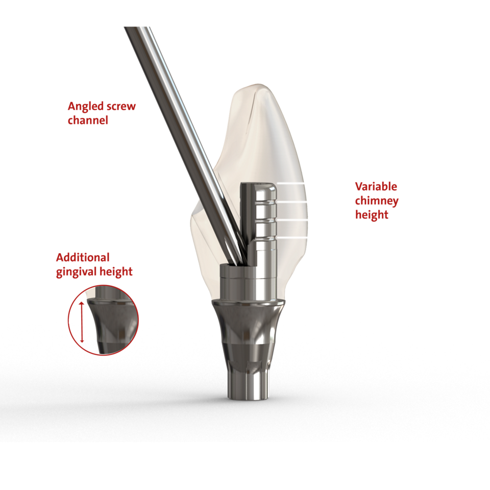 Elevate Your Dental Practice with MEDENTiKA® Prosthetic System | Book a ...