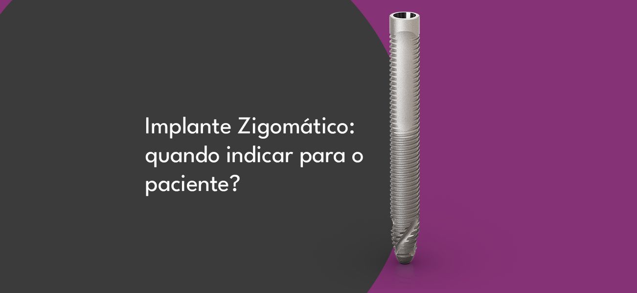 Implante Zigomático: quando indicar para o paciente?