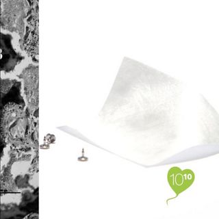 10 Jahre Jason® membrane
