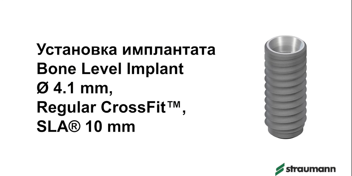 Установка имплантата: Straumann® Bone Level