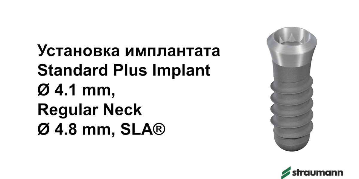 Установка имплантата: Straumann® Tissue Level