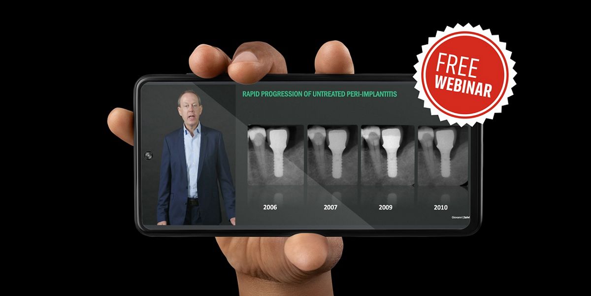 Webinar – Innovative peri-implantitis treatment with Straumann® GalvoSurge®