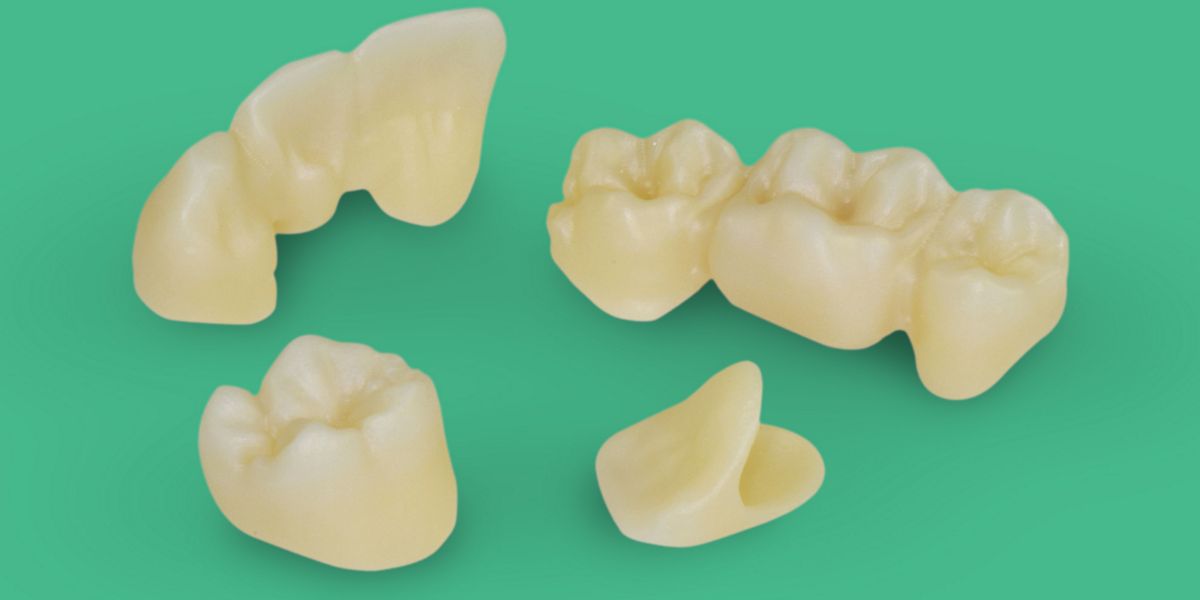 3M™ Lava™ Esthetic Zirconia | Dental Restoration