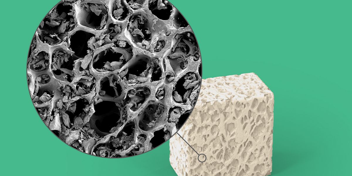 maxgraft® granules / blocks. Mastering natural results.