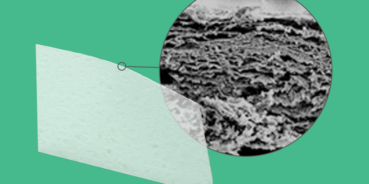 Straumann® Membrane Flex™. Dominar a resistência.