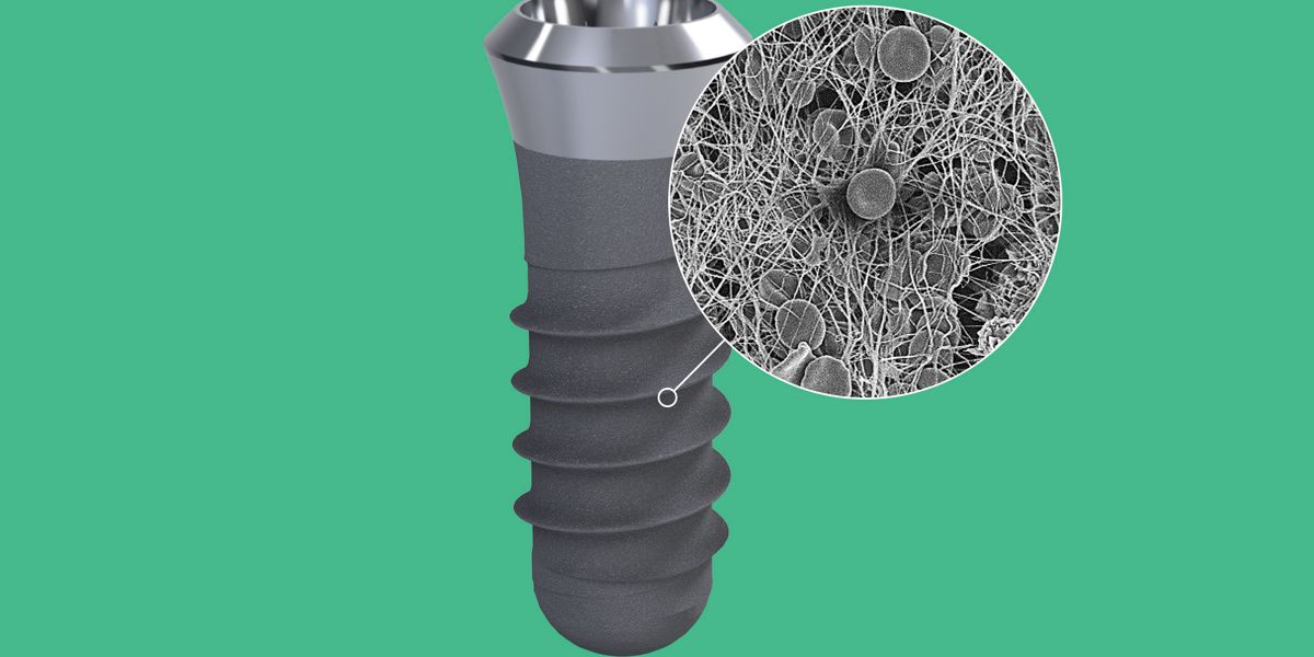 Straumann® SLActive® - Performance