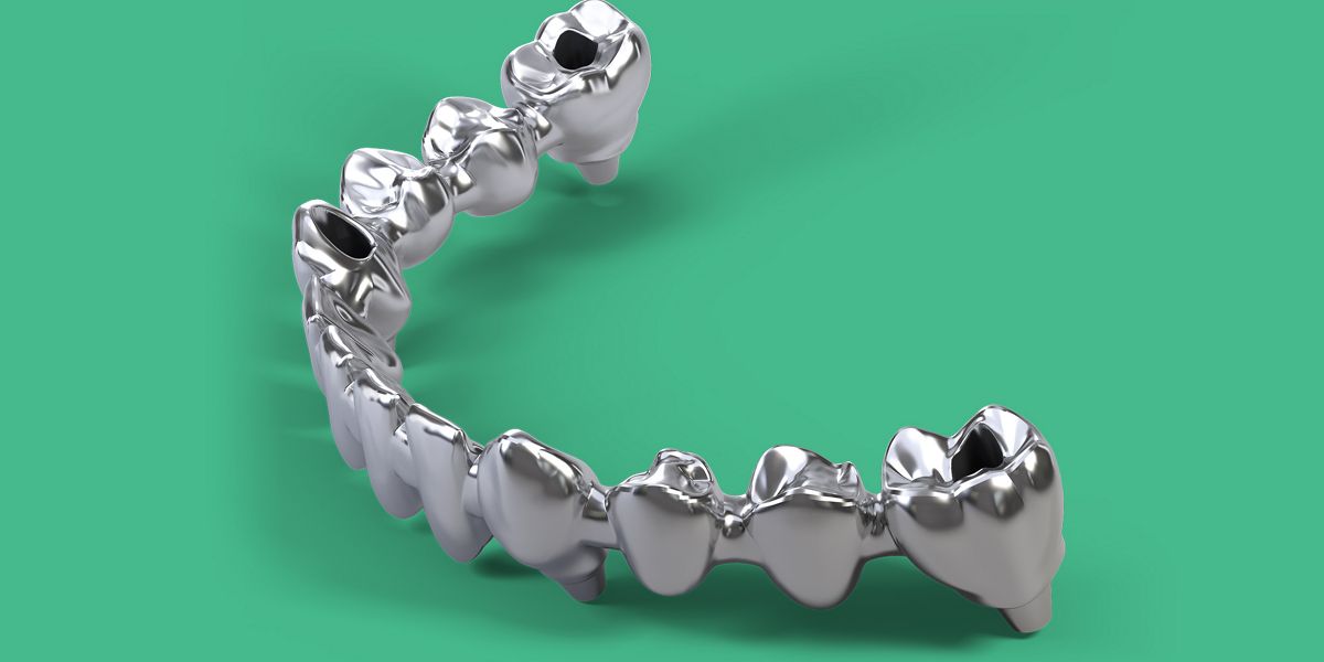 Scan & Shape 在线 CADCAM 设计服务 | 牙科修复体