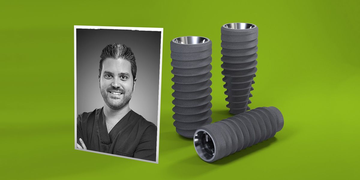 Palatal implant placement, crestal sinus lift and palatal bone ...