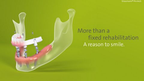 Solutions for edentulous patients