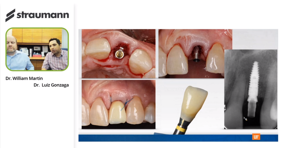 Campus Live Webinar with Dr. William Martin, Dr. Luiz Gonzaga: Smile in ...