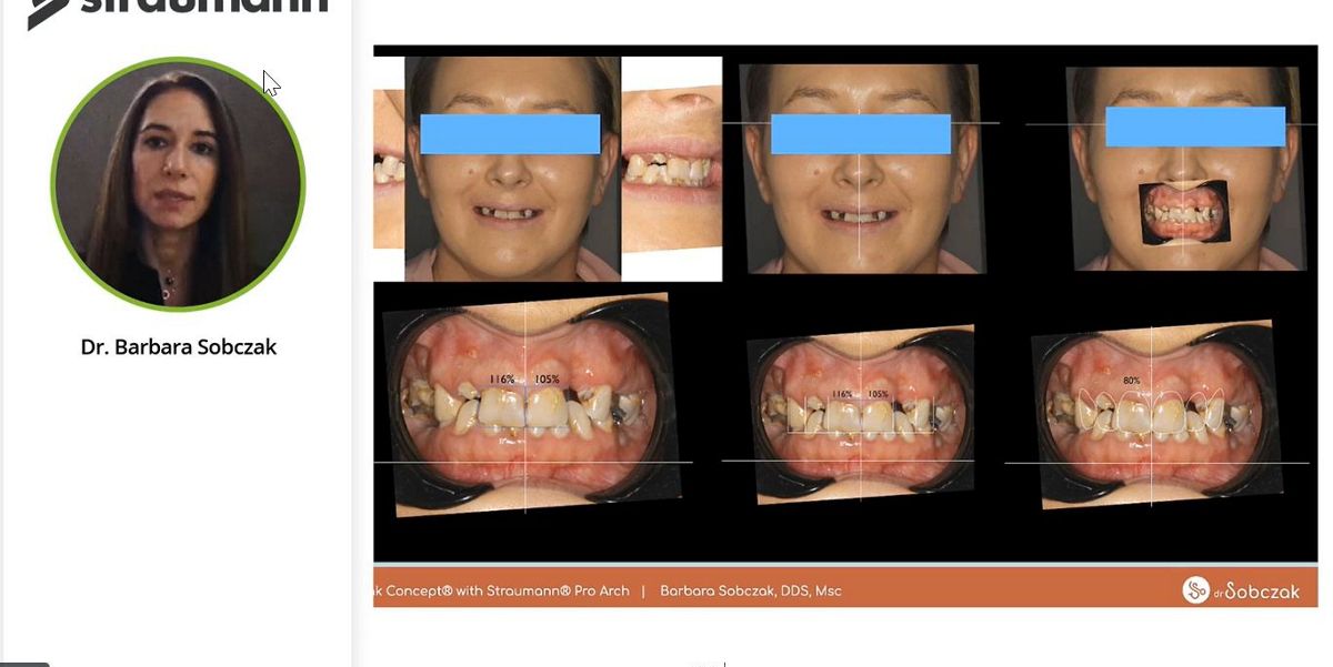 Campus Live Webinar with Dr. Barbara Sobczak: Fully digital protocol ...