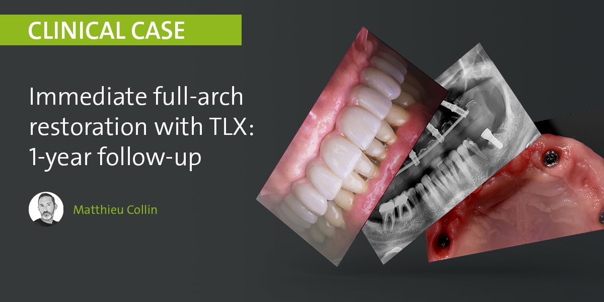 Immediate full-arch restoration with TLX implant system: 1 year follow ...