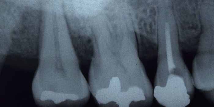 Mode of Action: Understanding the principle of “molecular mimicry ...