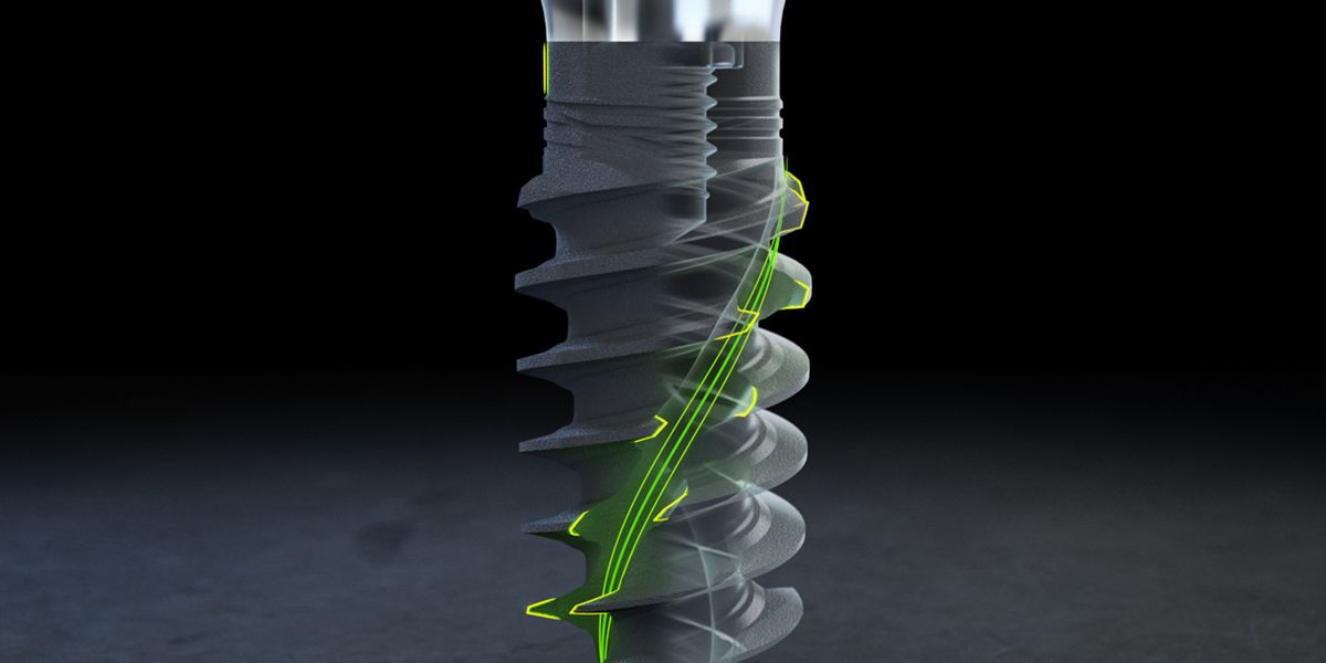Straumann® TLX Implant System: The next level of versatility