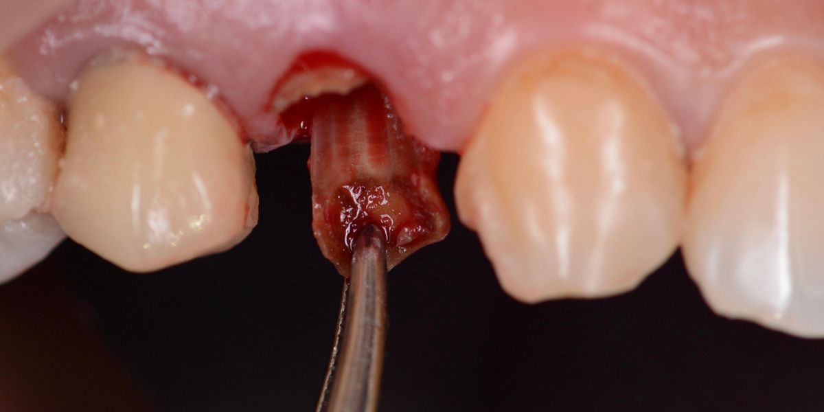 Application of artificial intelligence for the immediate transition of ...