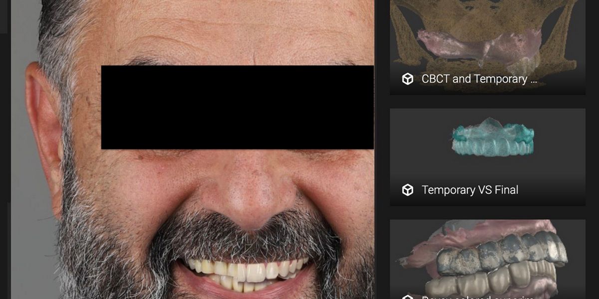 Clinical success in guided full-arch rehabilitation using Smilecloud