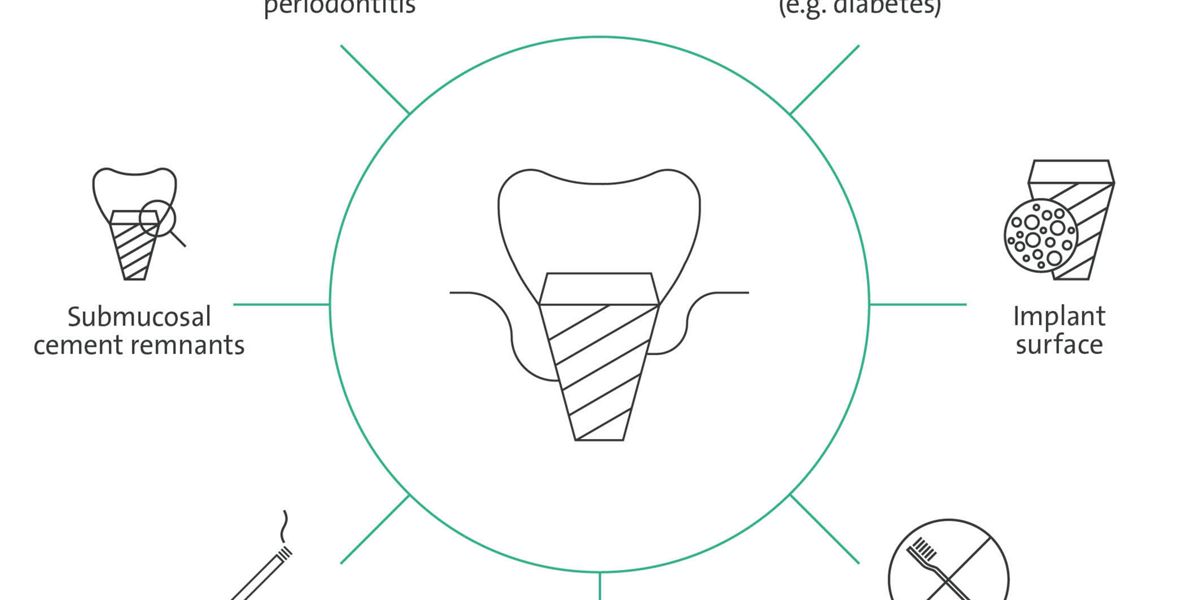 Managing peri-implantitis: a modern perspective