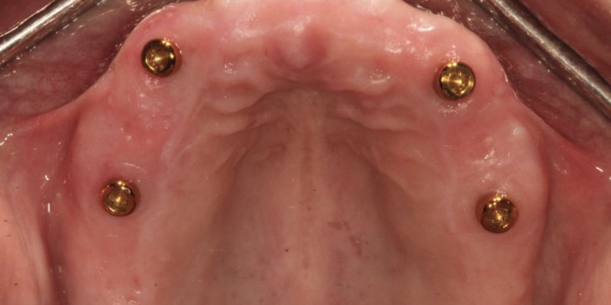 Enhancing Quality of Life: Successful Transition from LOCATOR ...