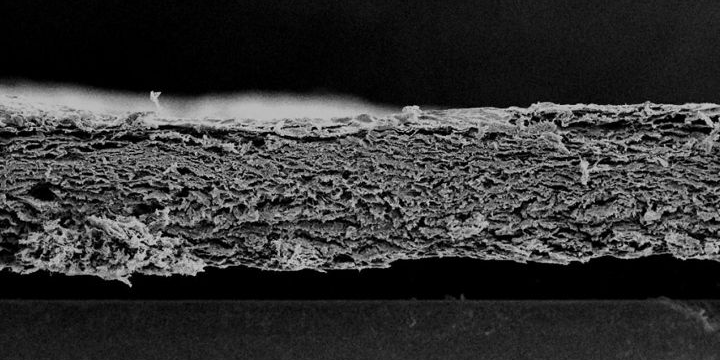 Stable, flexible, user-friendly: The Straumann® Membrane Flex in the ...